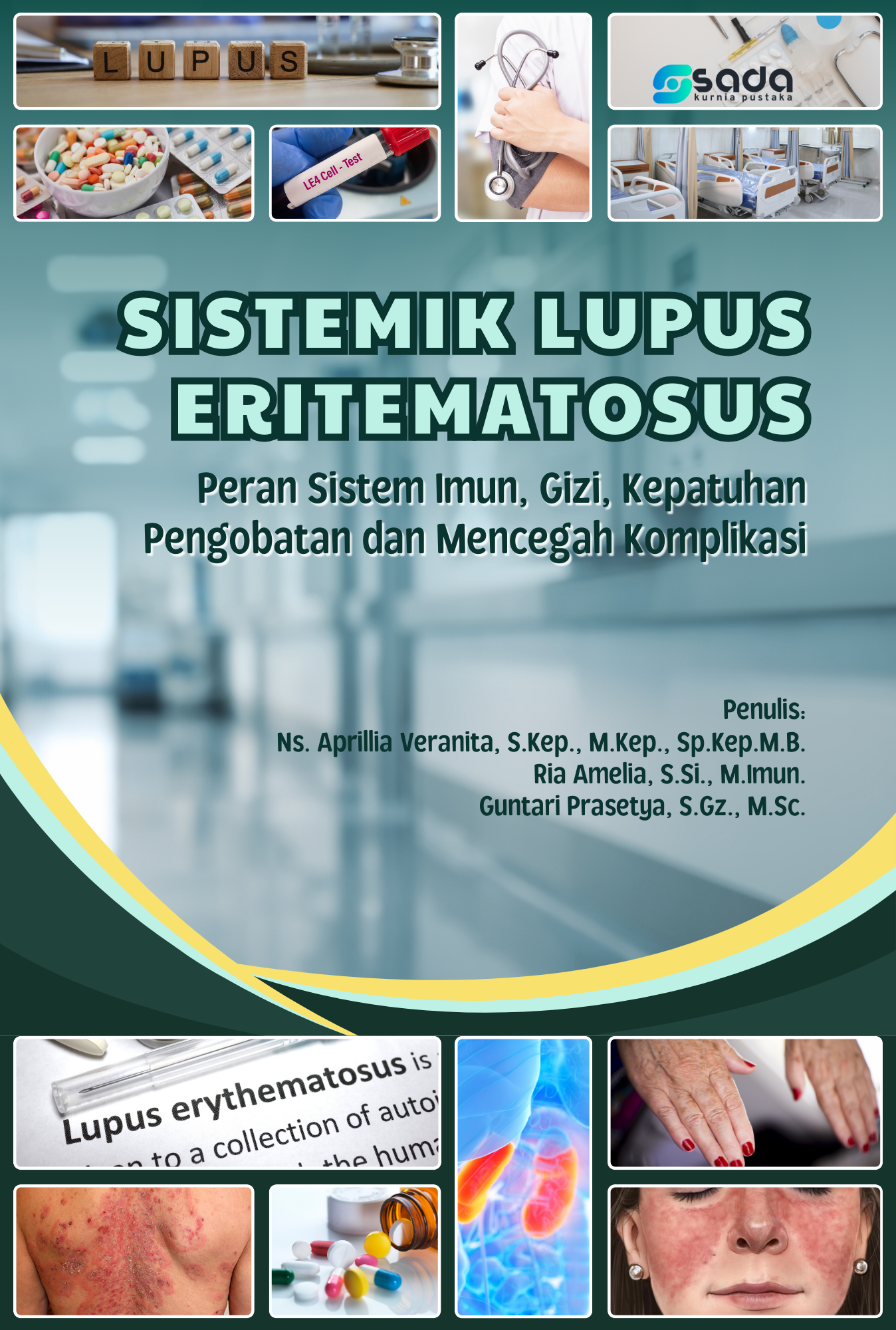 Sistemik Lupus Eritematosus: Peran Sistem Imun, Gizi, Kepatuhan ...